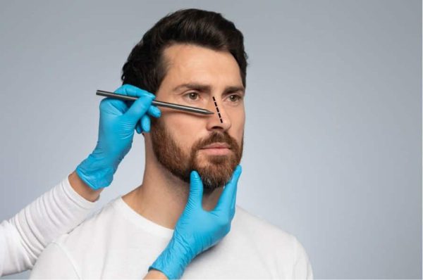 Revision Aesthetic Nose Surgery - TurkCure