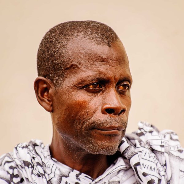 Types of Noses: Changes of The Nose under Rhinoplasty - TurkCure